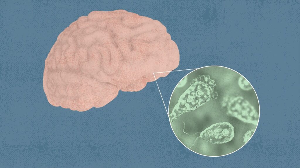 Understanding the Brain-Eating Amoeba: Strategies for Prevention ...